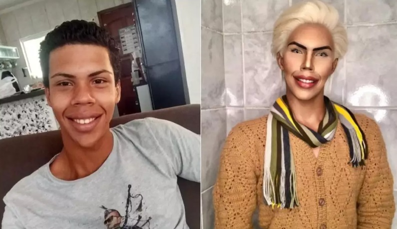 Estutante planeja realizar 42 cirurgias para se transformar no Ken ...